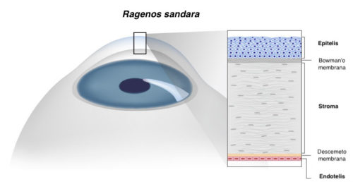 Ragenos distrofijos | Akių Gydytojų Praktika